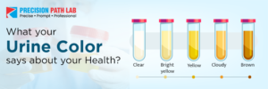 Urine Color Chart: What Your Urine Color Tell About Health
