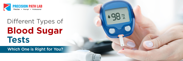 Different Types of Diabetes Tests You Should Know